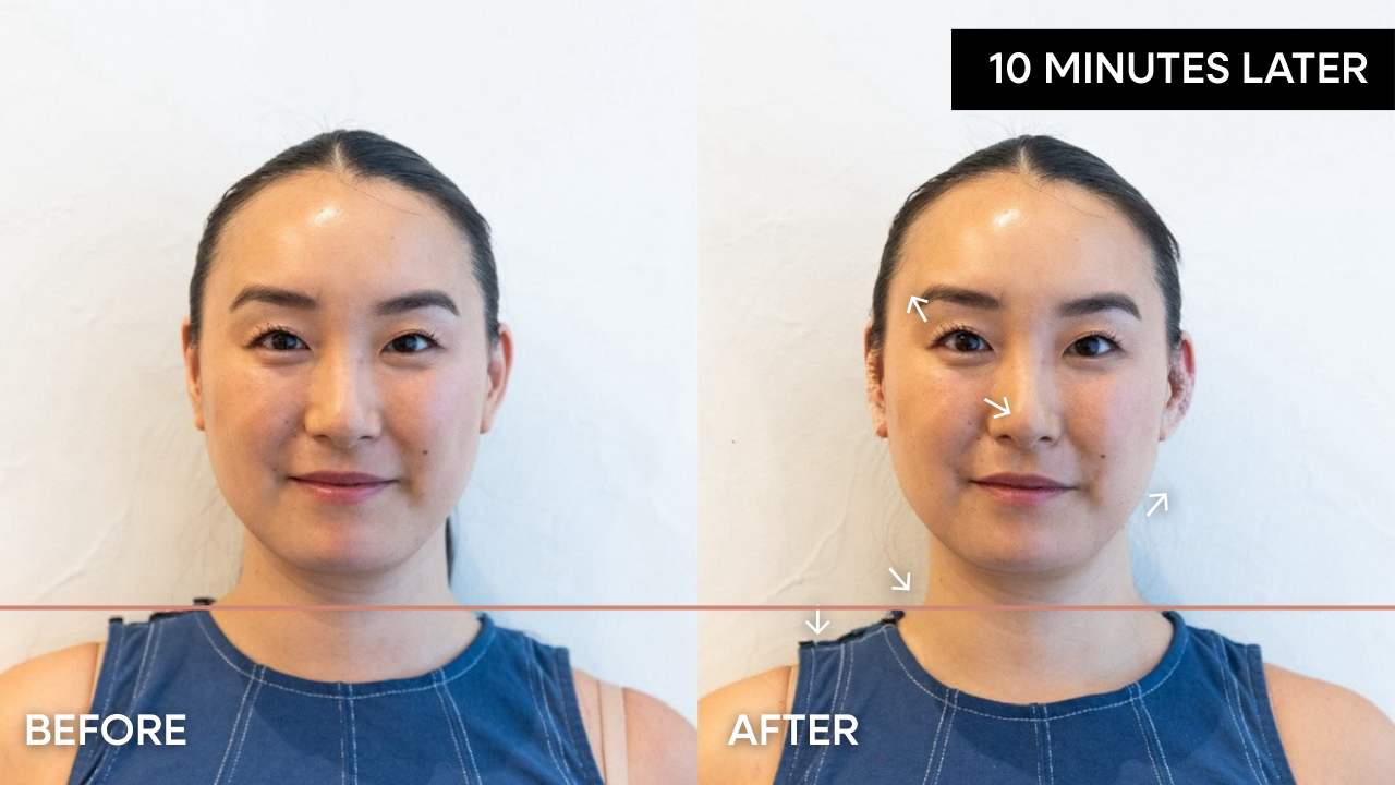 V-Line Ear Seed Kit – byAVA